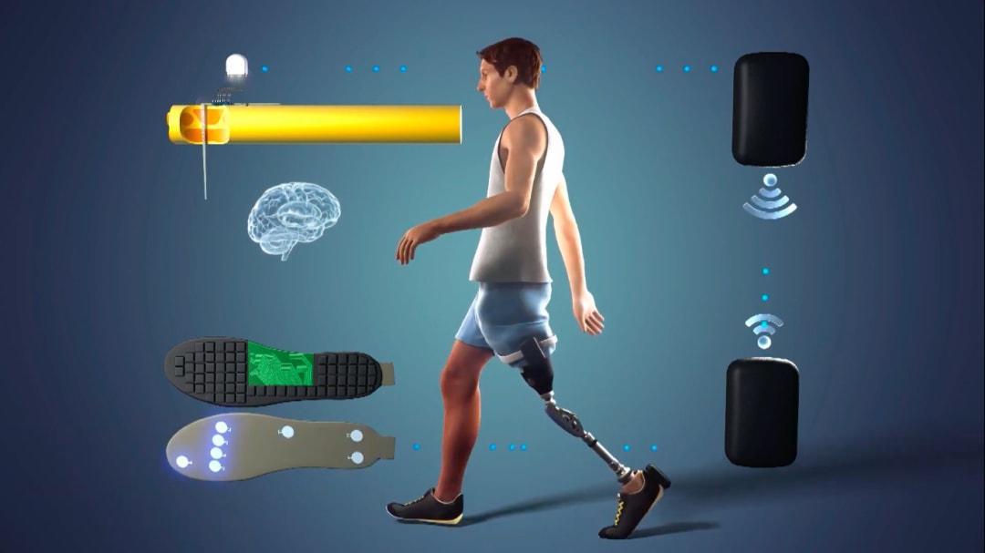 New prosthetic leg tech lets amputees feel foot, knee in real-time ...