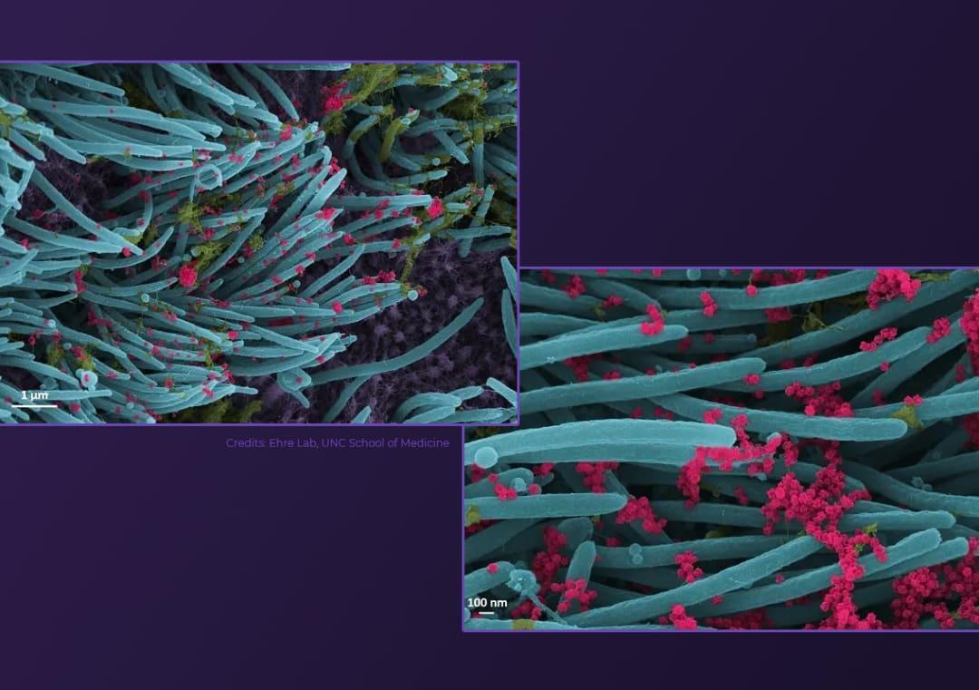 Researchers publish pics of cells infected with COVID-19