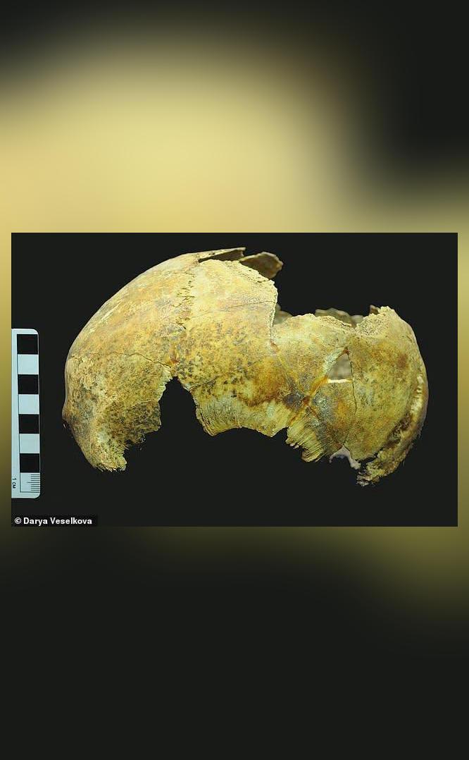 Skull of 5,000-yr-old man who underwent failed brain surgery found in ...