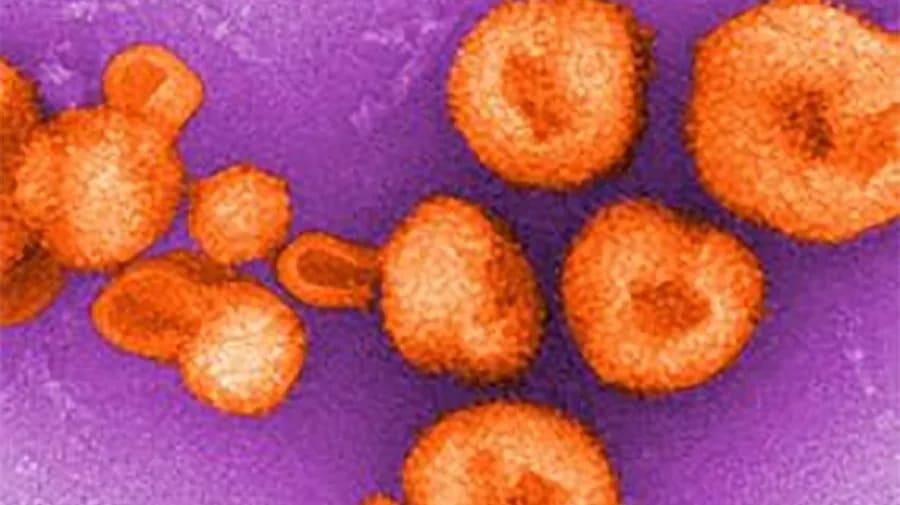 Human-to-human transmission of rare 'Chapare virus' in Bolivia confirmed