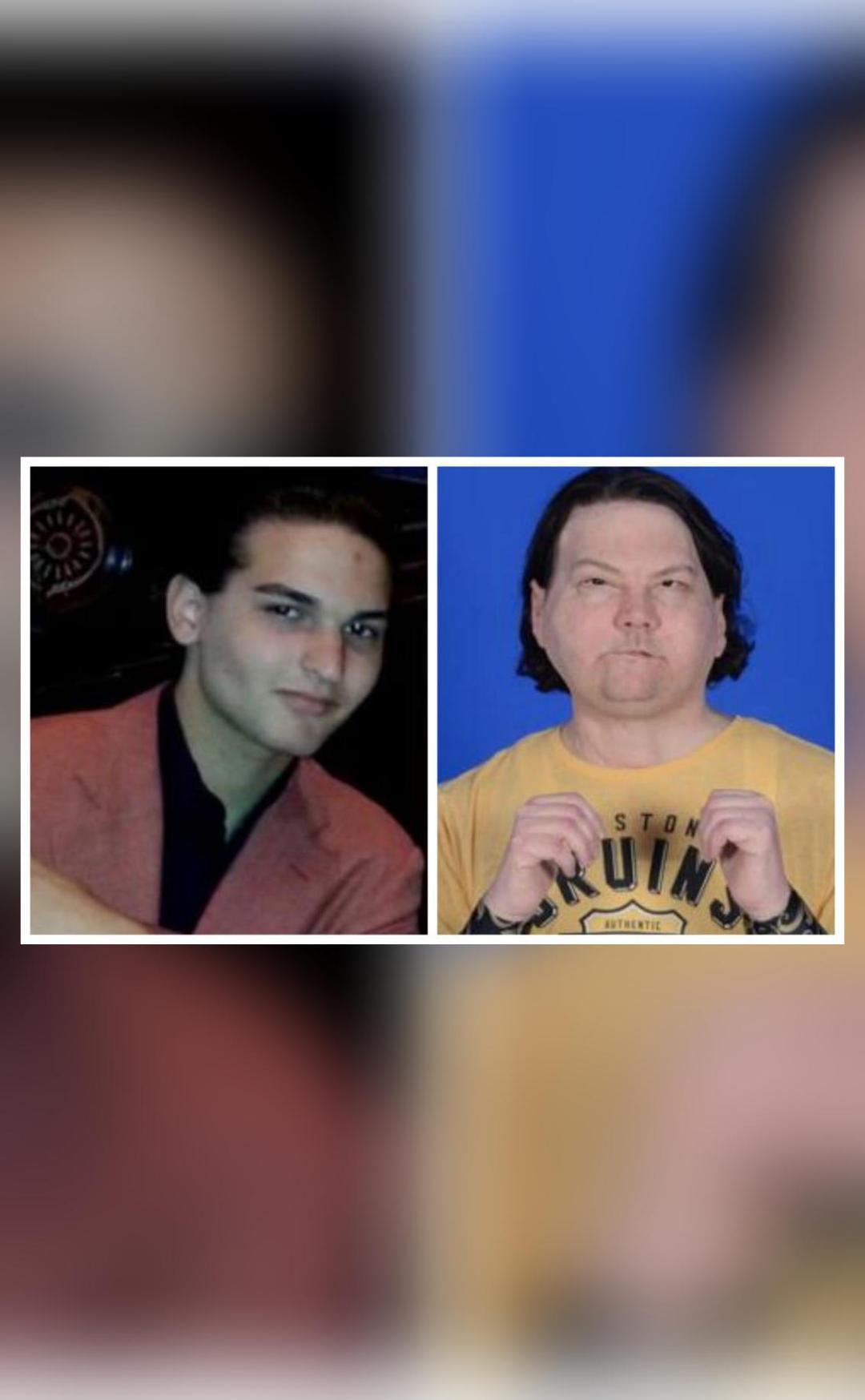22-year-old man receives world's first successful face and hands transplant