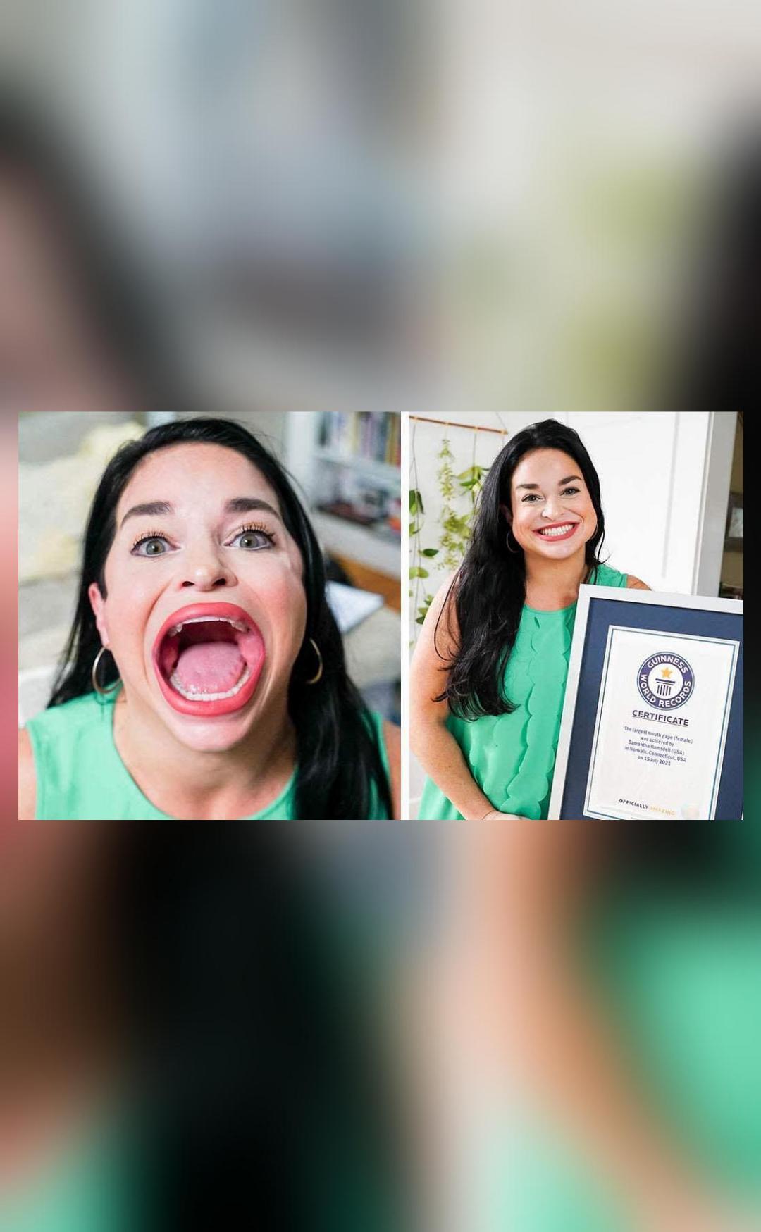 American woman sets Guinness World Record with 6.52-cm mouth gape ... American woman sets Guinness World Record with 6.52-cm mouth gape ...