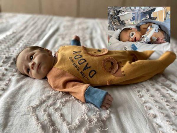 Baby born with organs outside the body in UK due to a rare condition