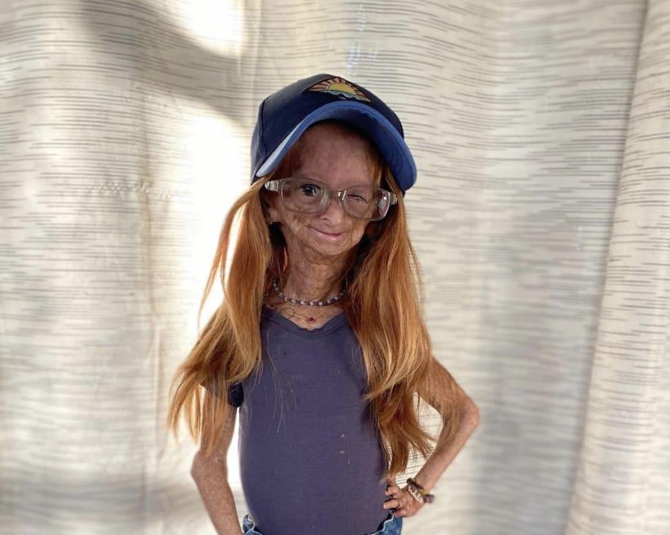 YouTube star Adalia Rose, who had progeria, dies aged 15 in US | World ...