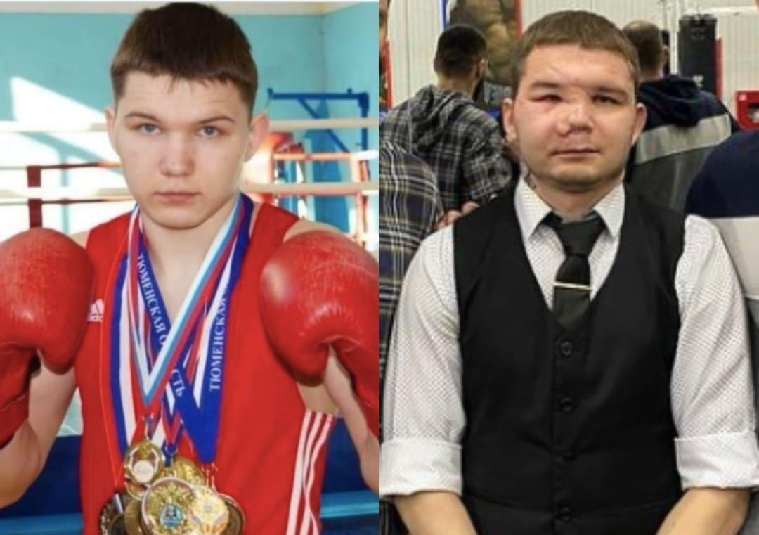 Boxer makes 1st public appearance after a brown bear disfigured his ...