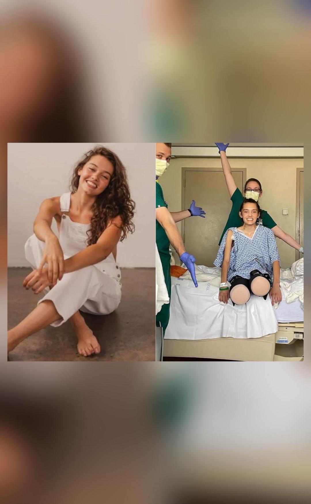20-yr-old aspiring model loses both her legs due to COVID-19 ...
