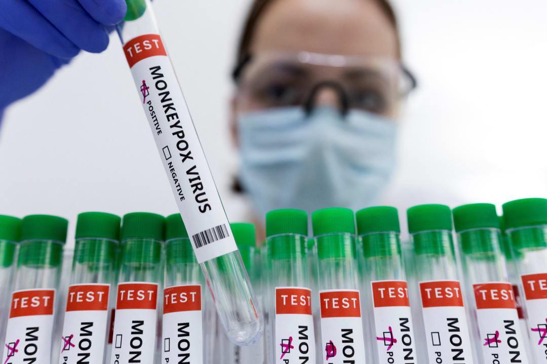 Philippines reports 1st monkeypox case, traces 10 close contacts ...