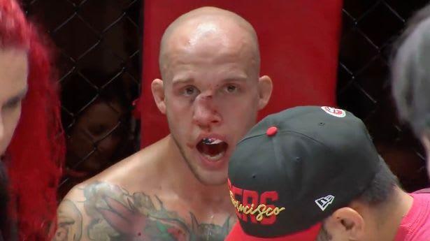 MMA fighter Blake Perry's face disfigured after opponent breaks his ...