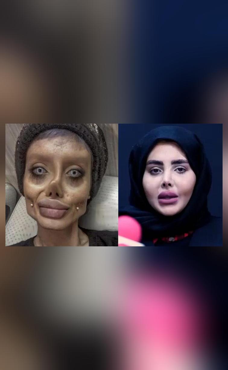 'Zombie Angelina Jolie' reveals her real face after release from Iran jail