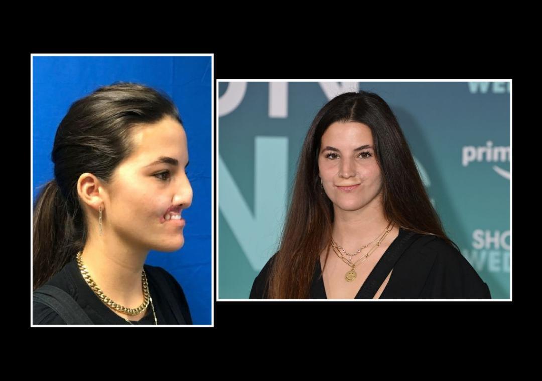 23-yr-old model who lost her lip in dog attack in US shares pic of ...