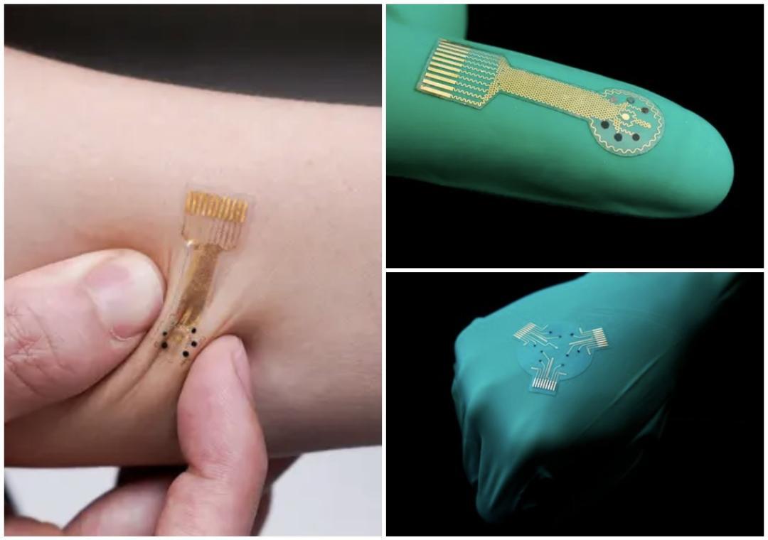 'Smart bandage' that gives real-time updates about wounds developed
