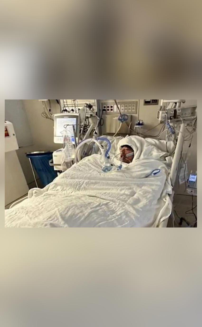 Boy left with 3rd degree burns after explosion during 'torch' TikTok ...