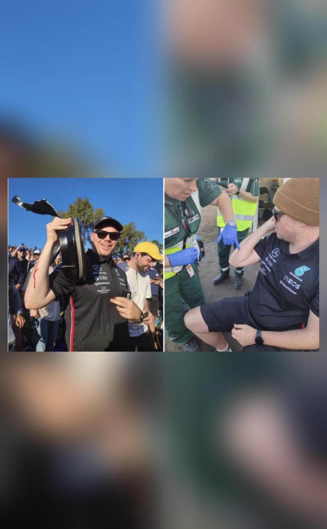 Fan left bleeding after being hit by car debris during F1 race in ...