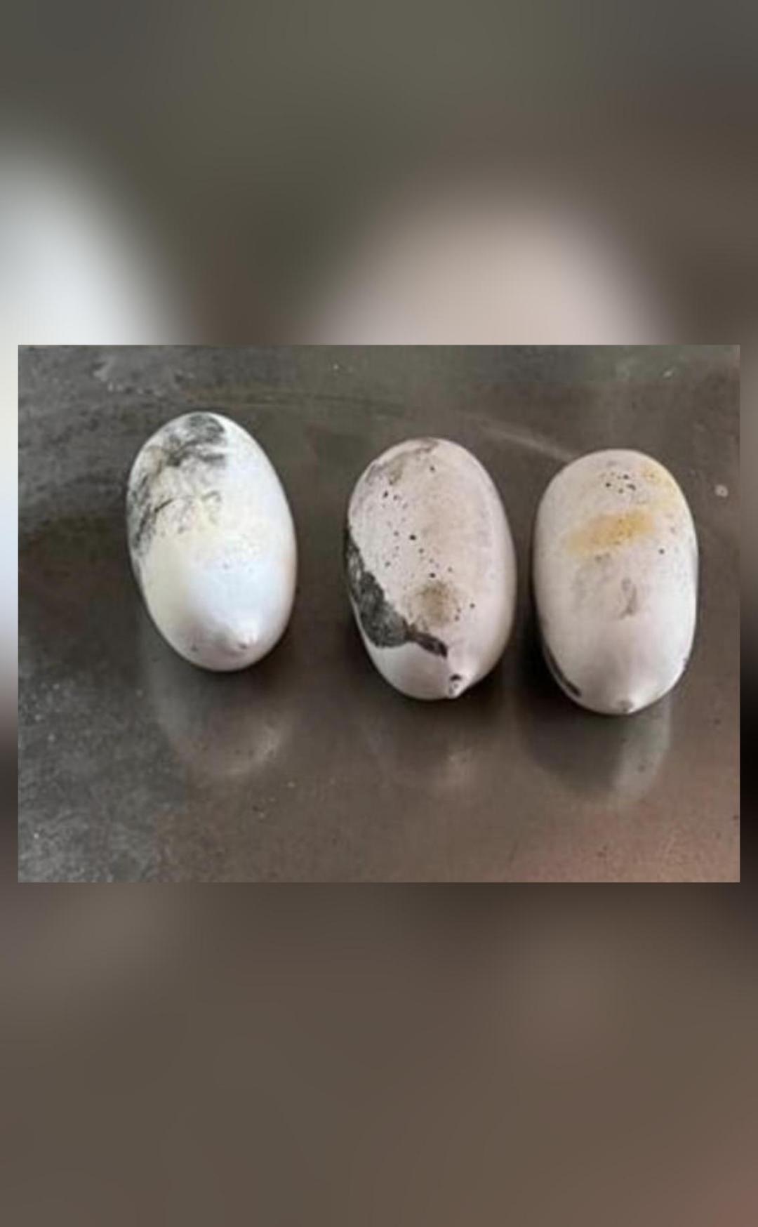 Gold worth ₹32 lakh hidden in man's body seized at Hyd airport