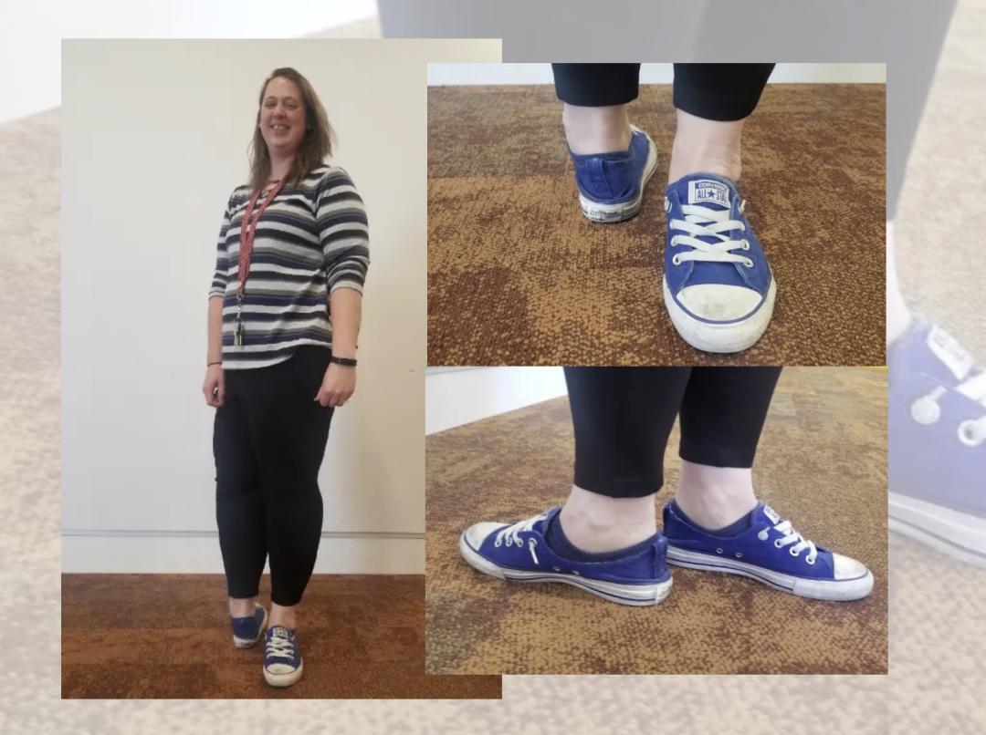 US woman breaks world record by rotating her foot 171.4 degrees