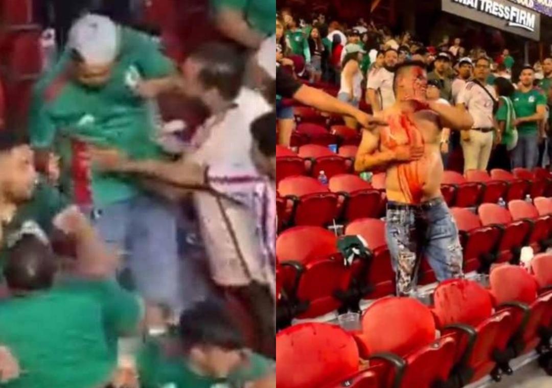 Fan soaked in blood after being stabbed in chest during Mexico-Qatar ...