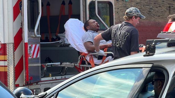 US man beaten with baseball bat for trying to stop attack on dog