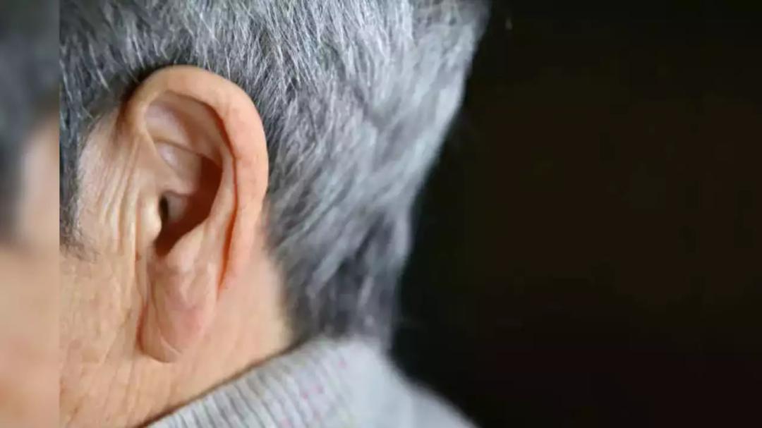 Can You Predict Heart Attack With An Ear Lobe Crease? | Health ...
