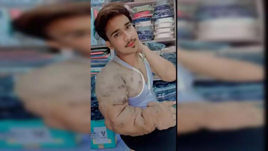 img_1710396908541_365.jpg?