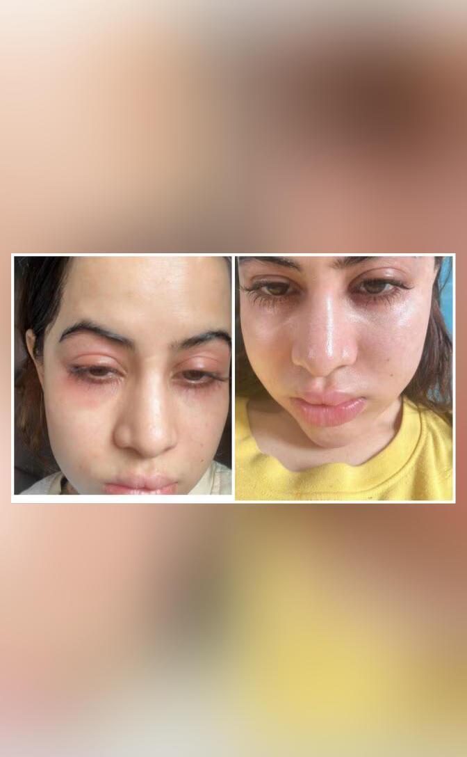 I've been getting Botox, fillers since I was 18: Uorfi as she shares ...